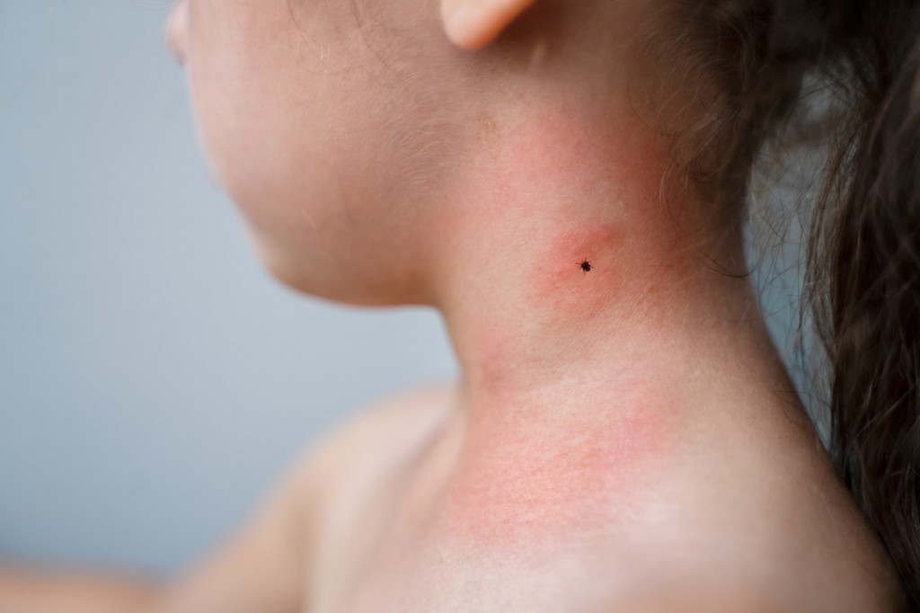 Ujed ovog akrepa je daleko gori i od stršljena: Kada vas "klintonka ...