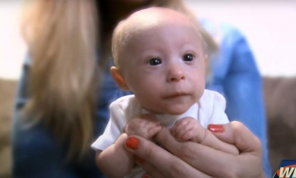 Beba rođena sa 450 grama sada ima 7 meseci i nosi odeću za lutke: Tek ...