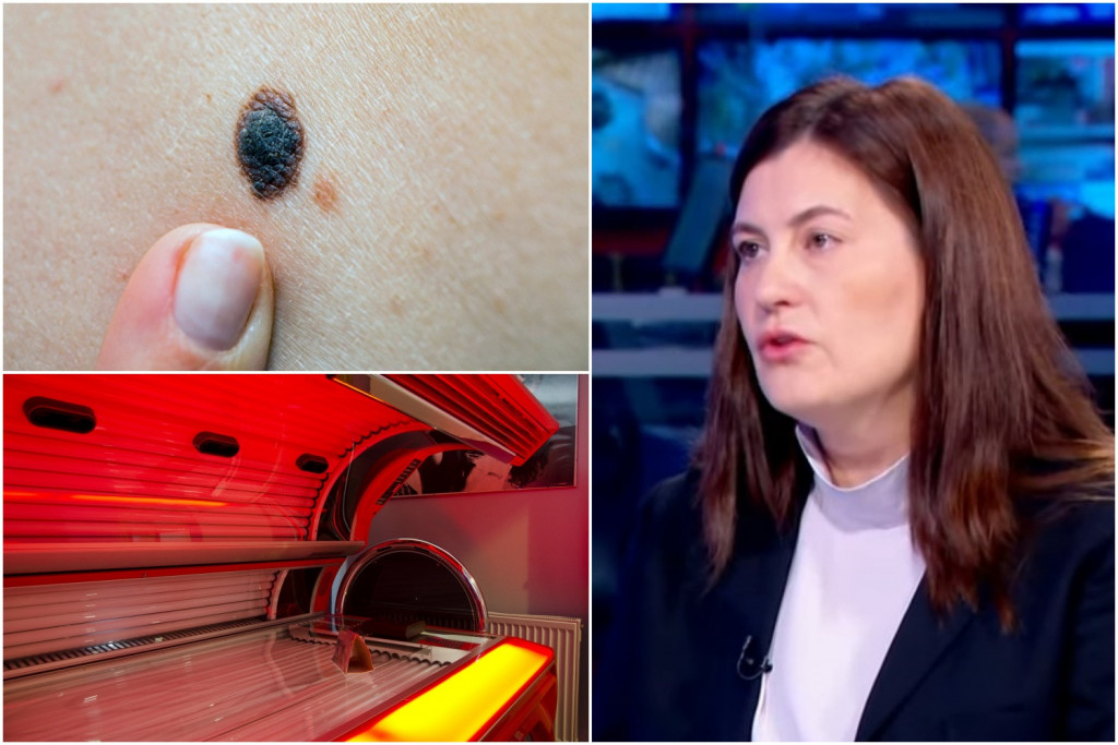 Melanom - Rak kože i solarijum