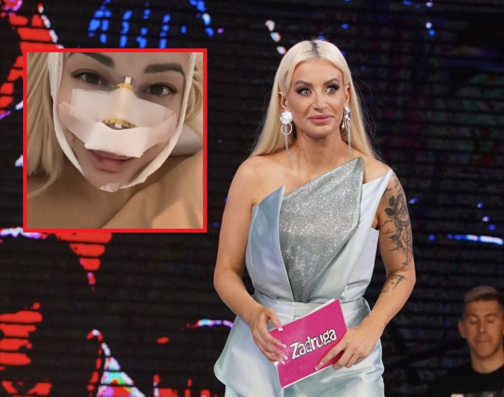 Dušica Jakovljević sva u zavojima posle operacije nosa
