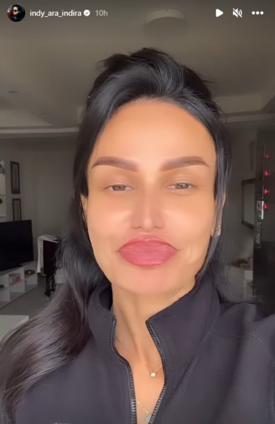 Indi Aradinović povećala usta