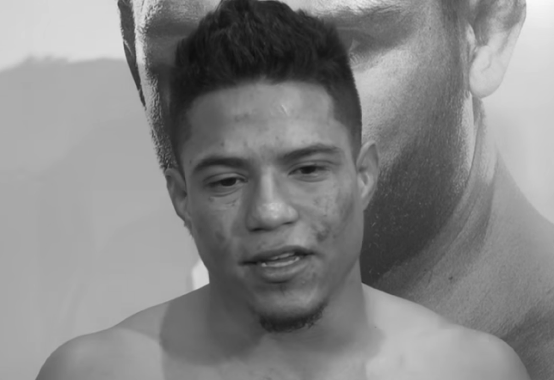 UFC borac stradao u saobraćajnoj nesreći
