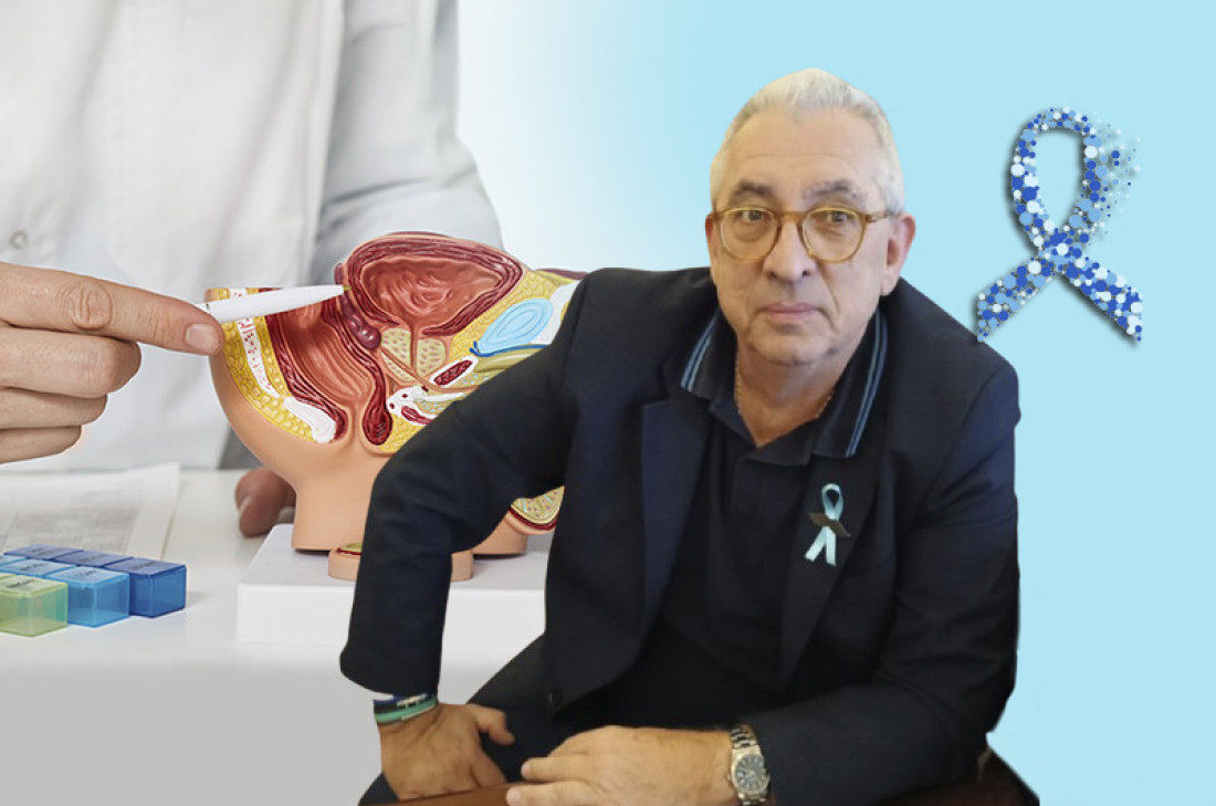 Rak prostate u Srbiji